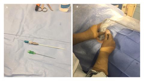 Safe Femoral Access: Using All the Tools in the Toolbox | SCAI
